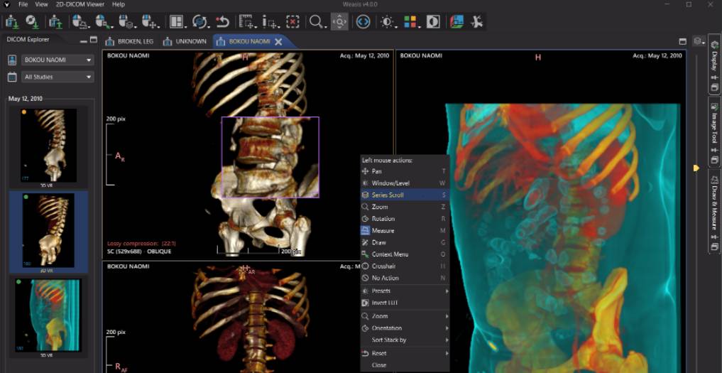 Visor Dicom Software Open Source Medical - Tiempo de Frikis
